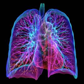 Degloving Injury by Mike Devlin / Science Photo Library