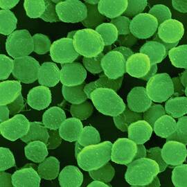 Methanococcus Jannaschii Archaea by Dennis Kunkel Microscopy / Science ...