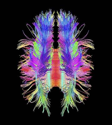 Tracking Wall Art for Sale by Science Photo Library